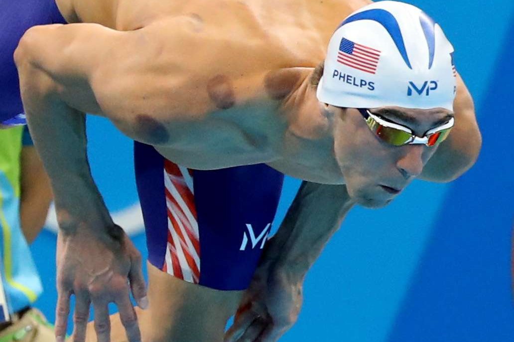 VIDÉO - JO Rio 2016 : pourquoi Michael Phelps a-t-il des marques rouges ...