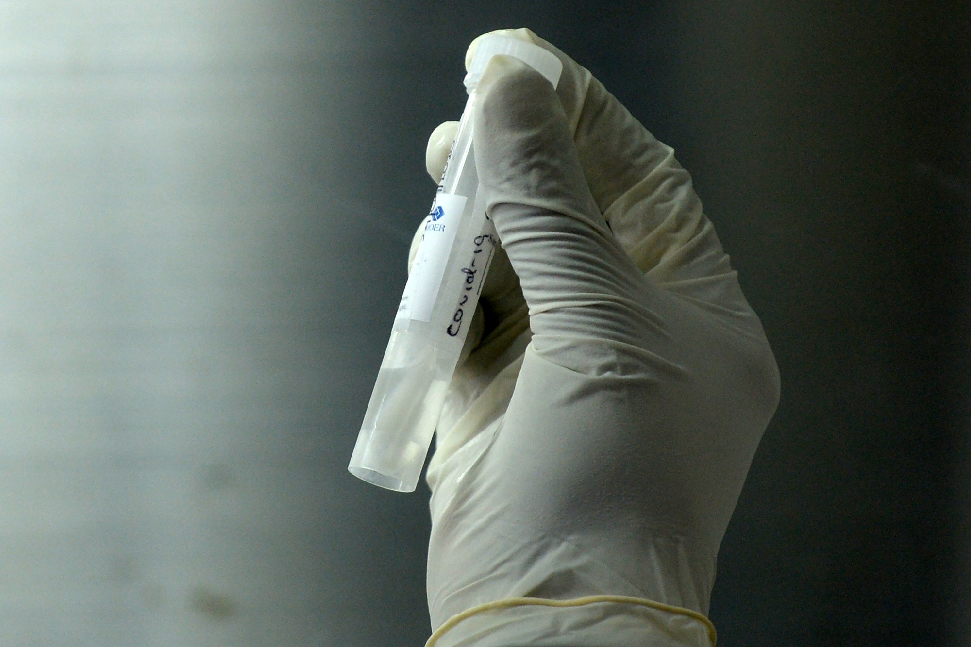 Coronavirus : "Il faut des préleveurs" pour effectuer les tests, dit un ...